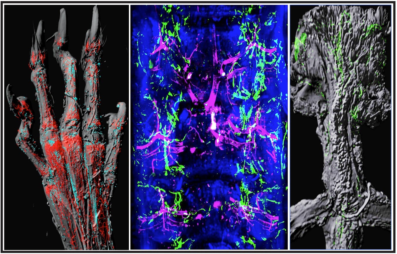 Role of lymphatic system in bone healing revealed | University of Oxford