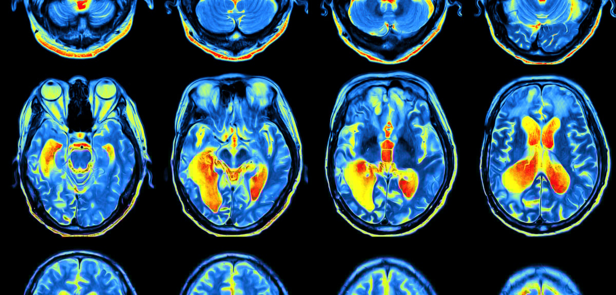 How our brains remember things depends upon how we learn them ...