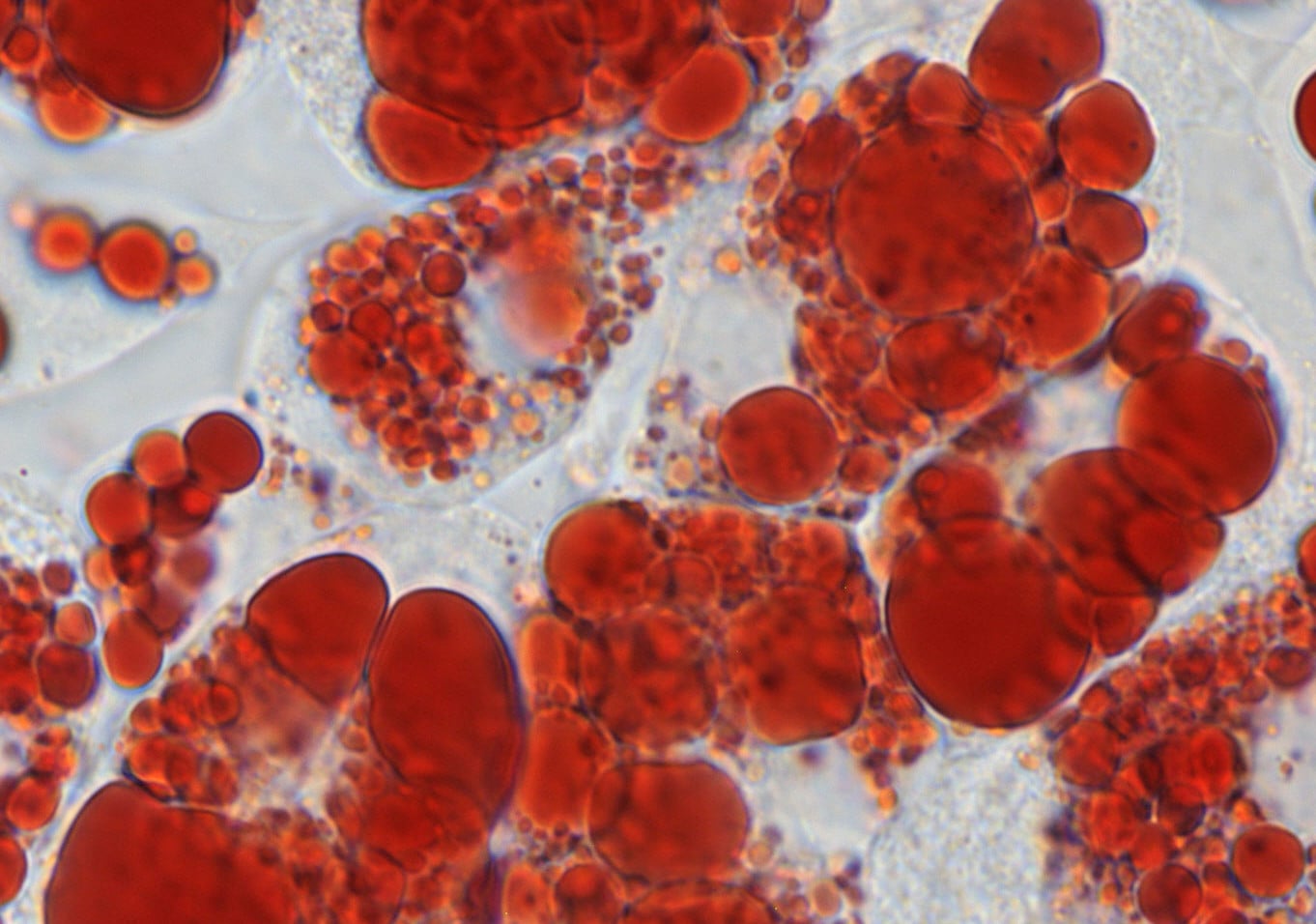 New function of obesity gene revealed | University of Oxford