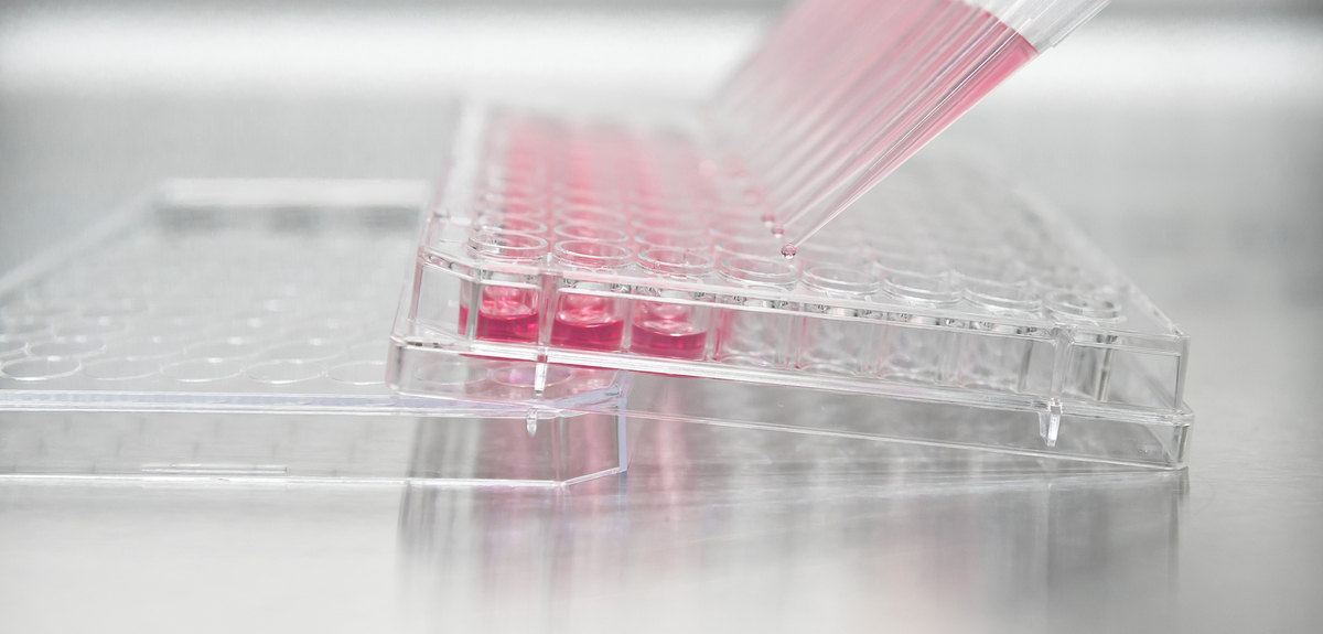 Pressure flips the switch on cancer cells | University of Oxford