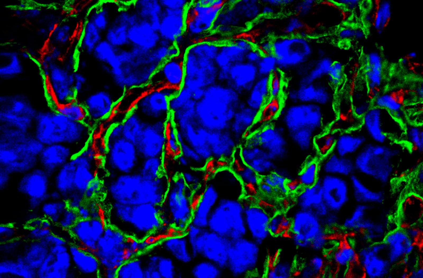 Cancer turns blood vessels over to its cause | University of Oxford