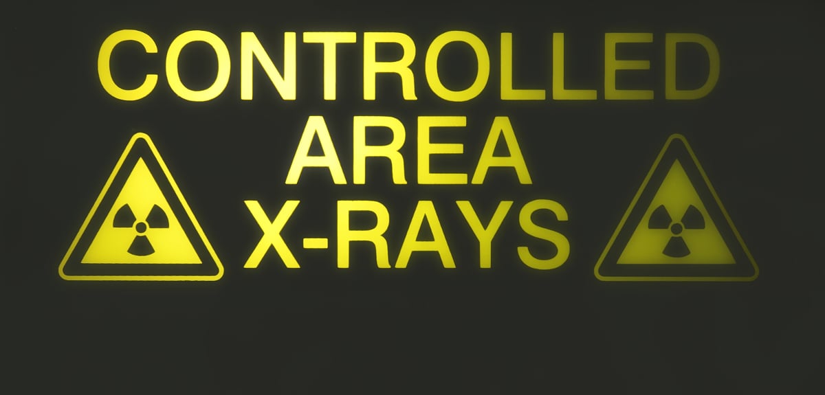 A breath of fresh air – Shedding light on oxygen, radiation and cancer ...