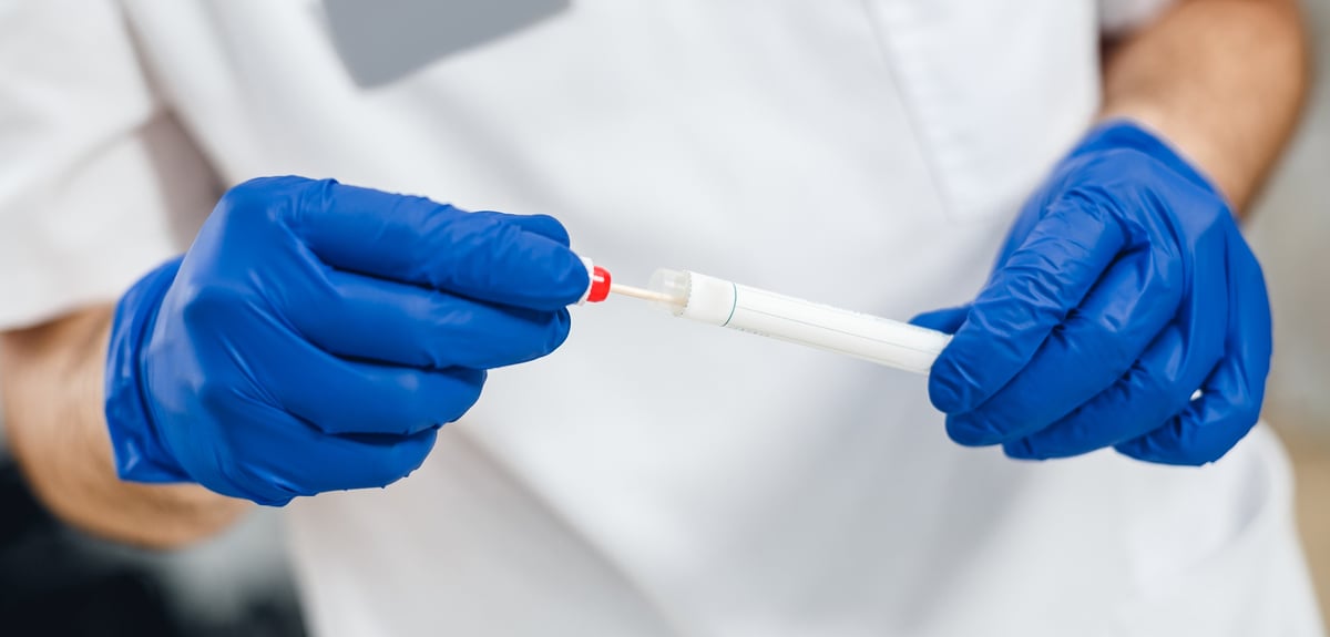 New Oxford co-led platform to accelerate COVID-19 tests into real-world ...