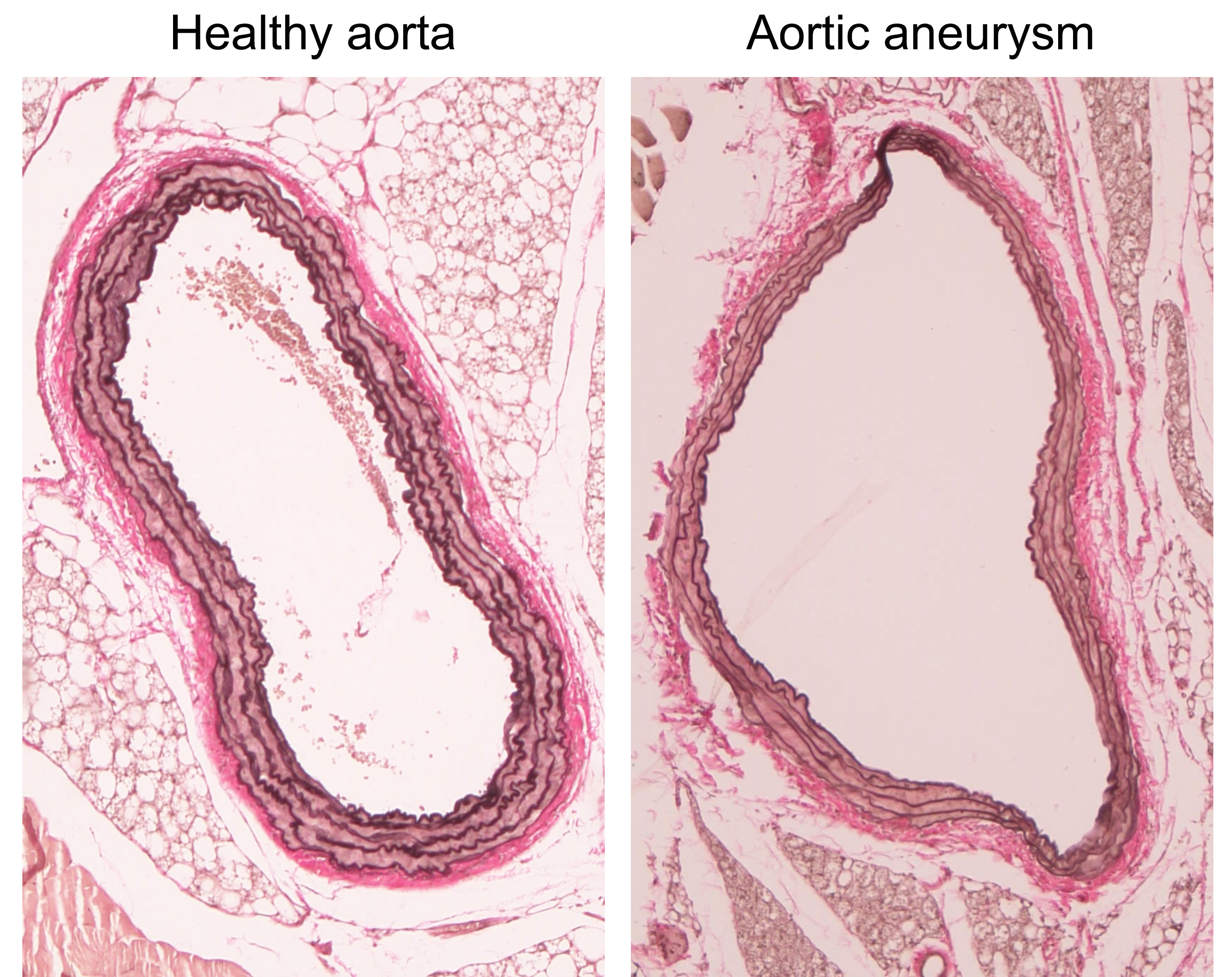 Aorta Microscope Image Labeled